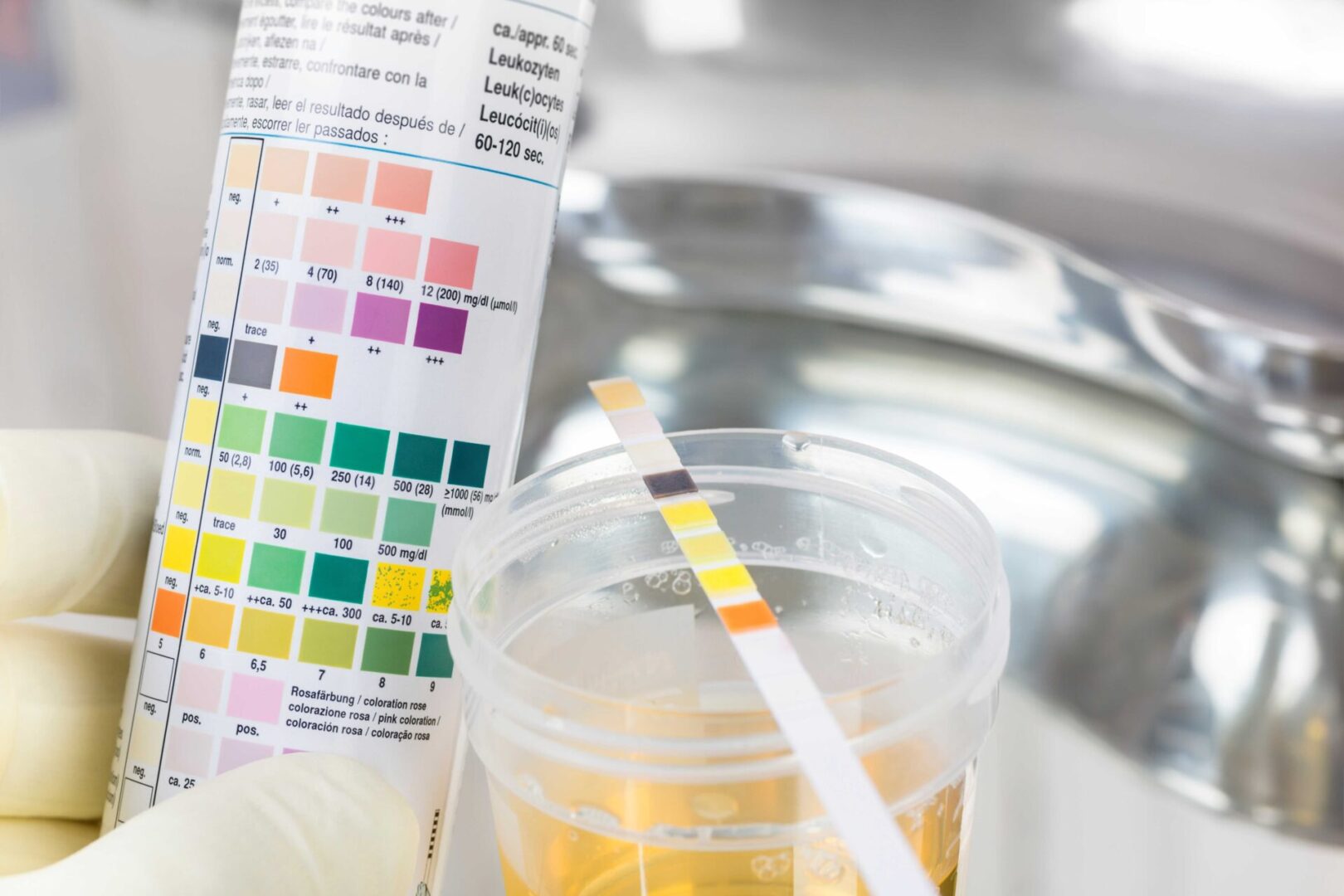 Understanding Urine Testing: Procedures and Interpretation - Advanced ...